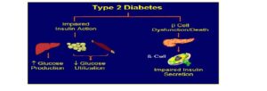 Diabetes Mellitus - Nurses Revision