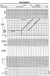 Partograph - Nurses Revision
