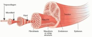 Tendonitis - Nurses Revision