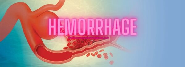 Hemorrhage - Nurses Revision