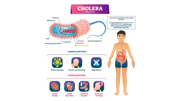 Cholera - Nurses Revision