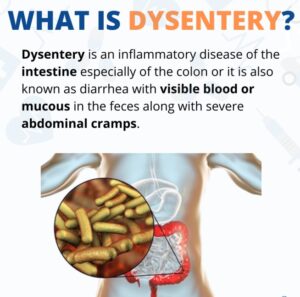 Dysentery - Nurses Revision