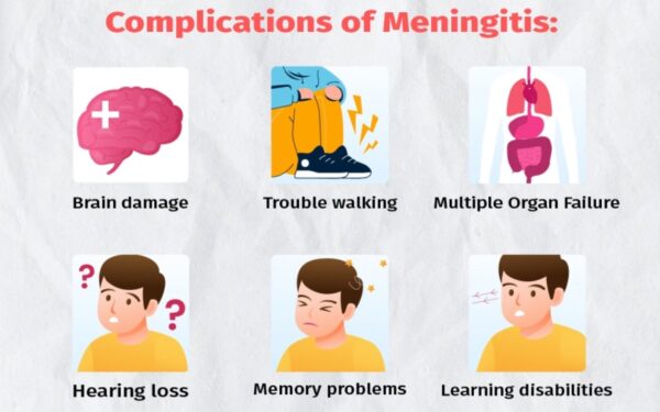 MENINGITIS - Nurses Revision