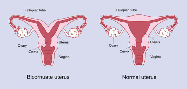 Congenital Abnormalities of the Reproductive Organs - Nurses Revision