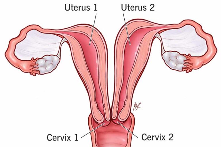 Congenital Abnormalities of the Reproductive Organs - Nurses Revision