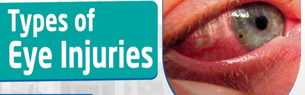 Eye Injuries in Children - Nurses Revision