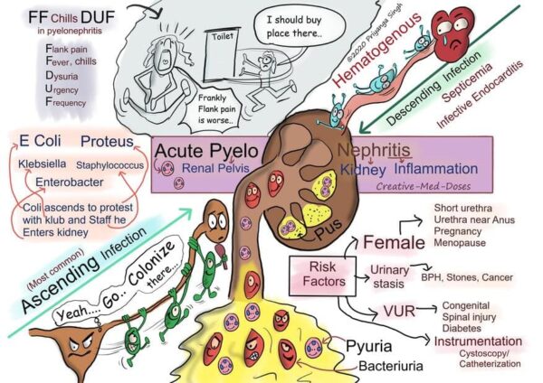 PYELONEPHRITIS - Nurses Revision
