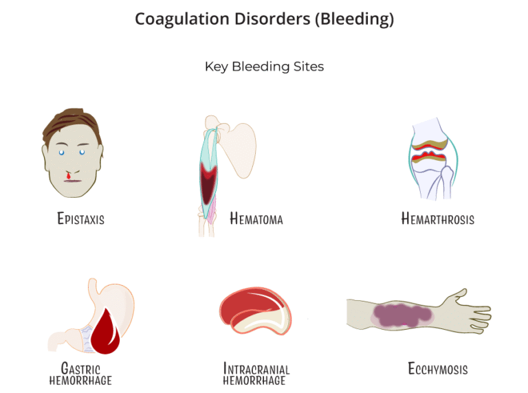 COAGULATION DISORDERS - Nurses Revision