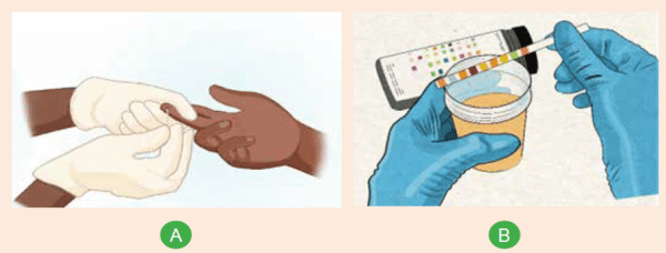 Simple laboratory tests - Nurses Revision